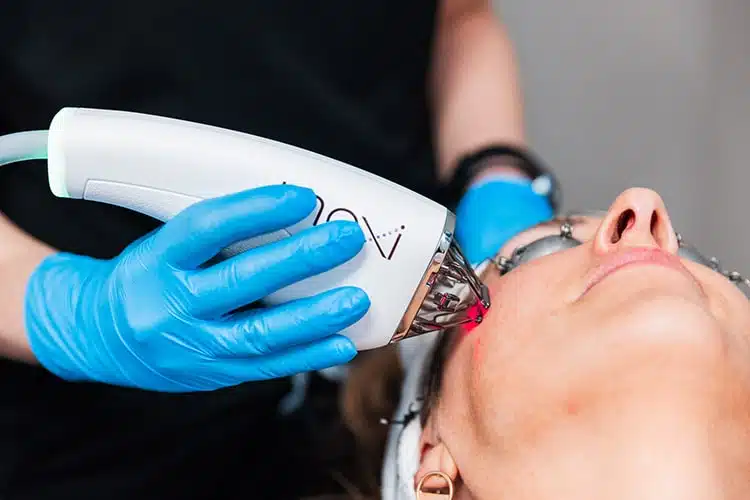 The Bbl Moxi™ Laser Facial Radiant A Medspa